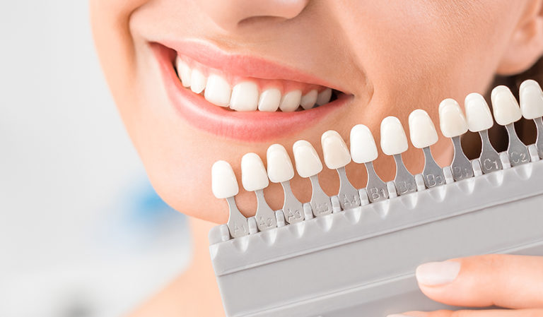 Tooth Shade Guide – Baker Street Dental