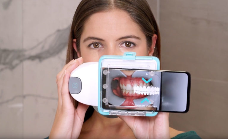 Invisalign Comprehensive – Baker Street Dental