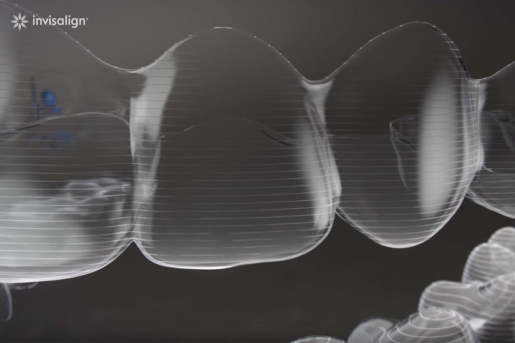 Invisalign Express – Baker Street Dental